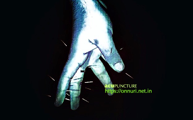 ONNURI – Believe in CURE!